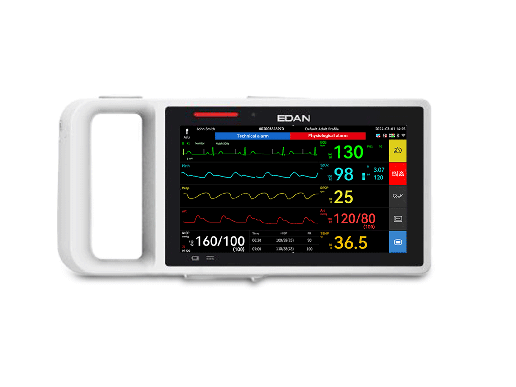 iV Monitor iV100 | Share our vision.