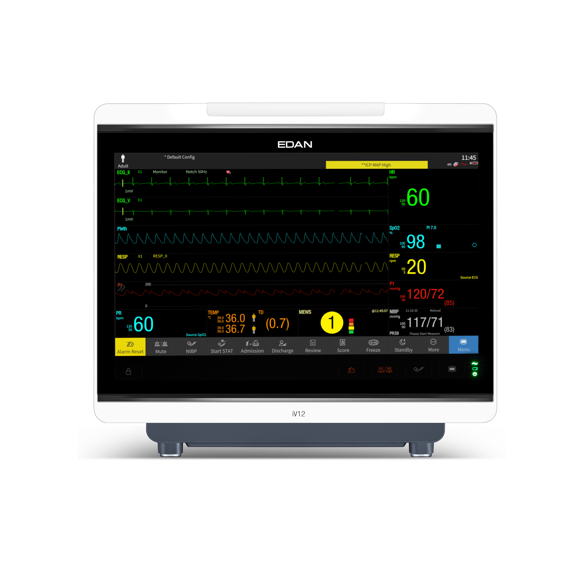 iV Modulární monitor iV12 | Share our vision.